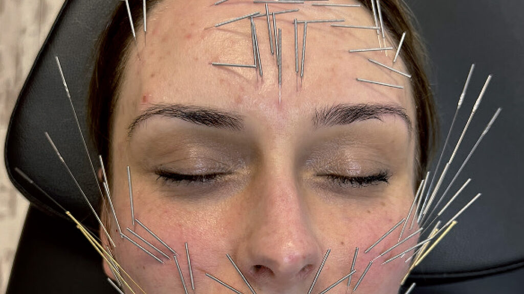 Needle Shaping i Thuzzle. Duet idealny w medycynie regeneracyjnej ...